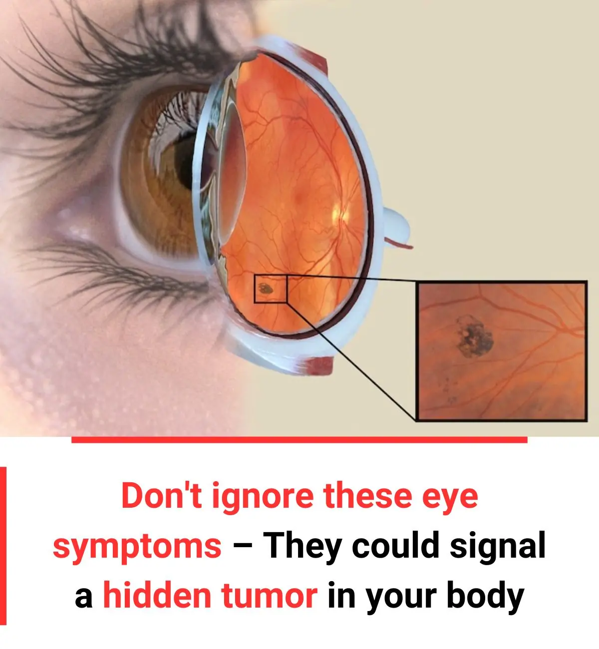 Don't Ignore These Eye Symptoms