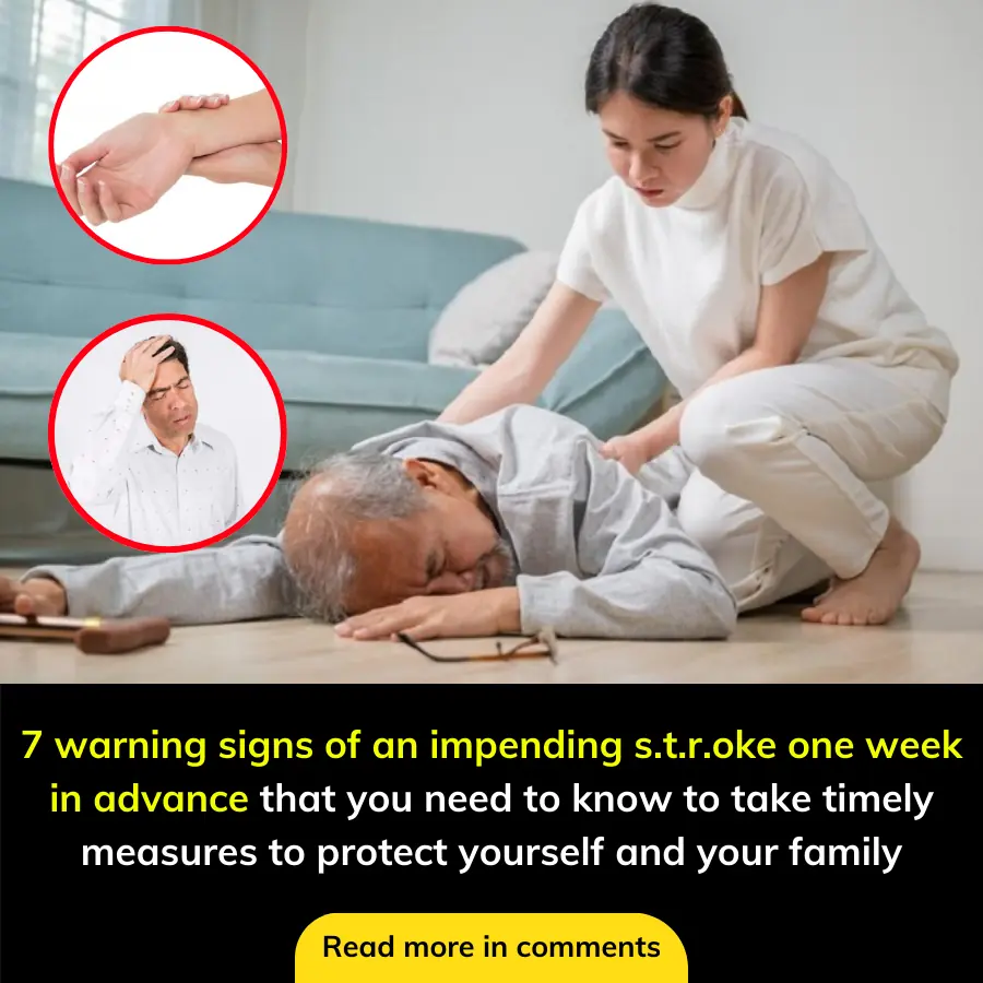 7 warning signs of an impending s.t.r.oke one week in advance