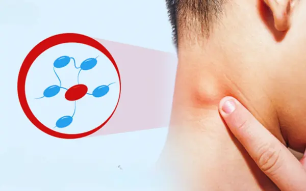 How to identify benign and malignant lymph nodes