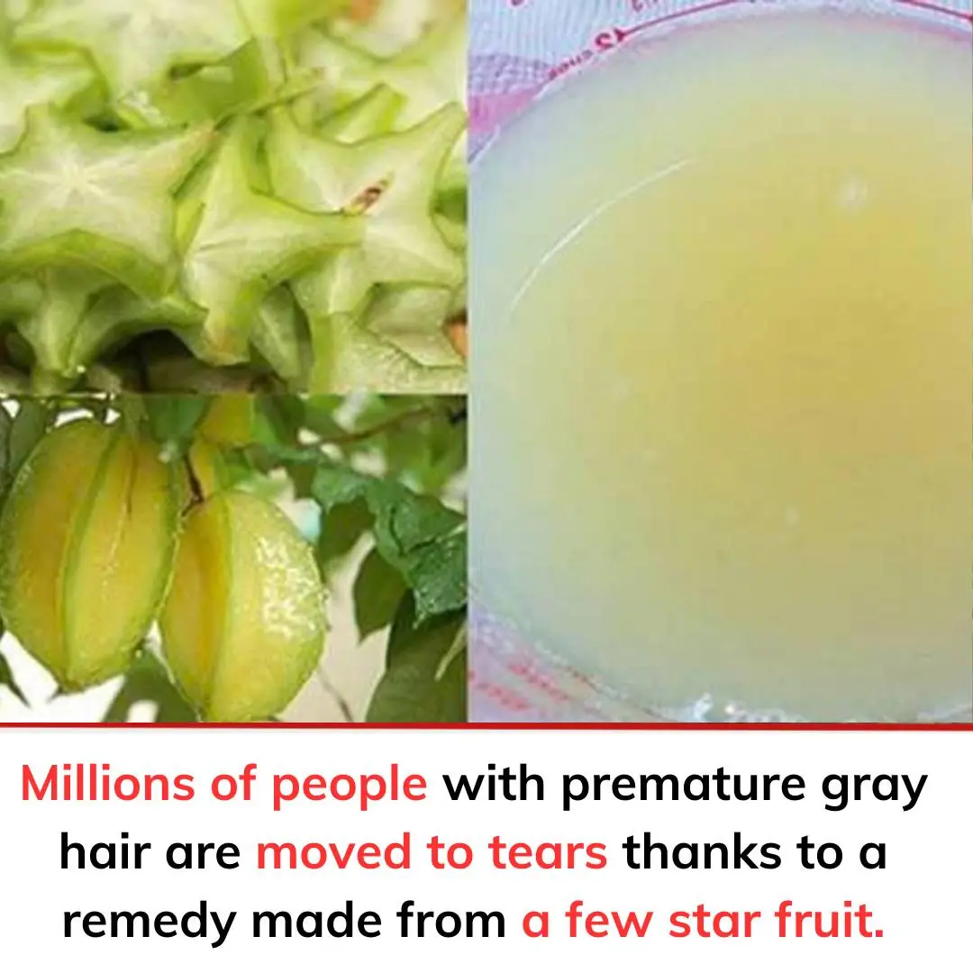 Millions of people with premature gray hair