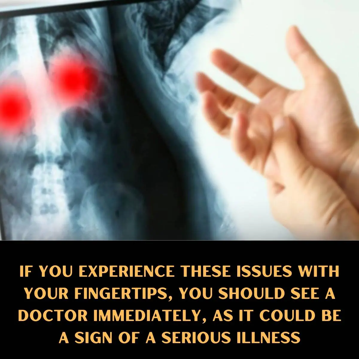 Doctors reveal signs on the fingers that indicate a risk of 'lung cancer'