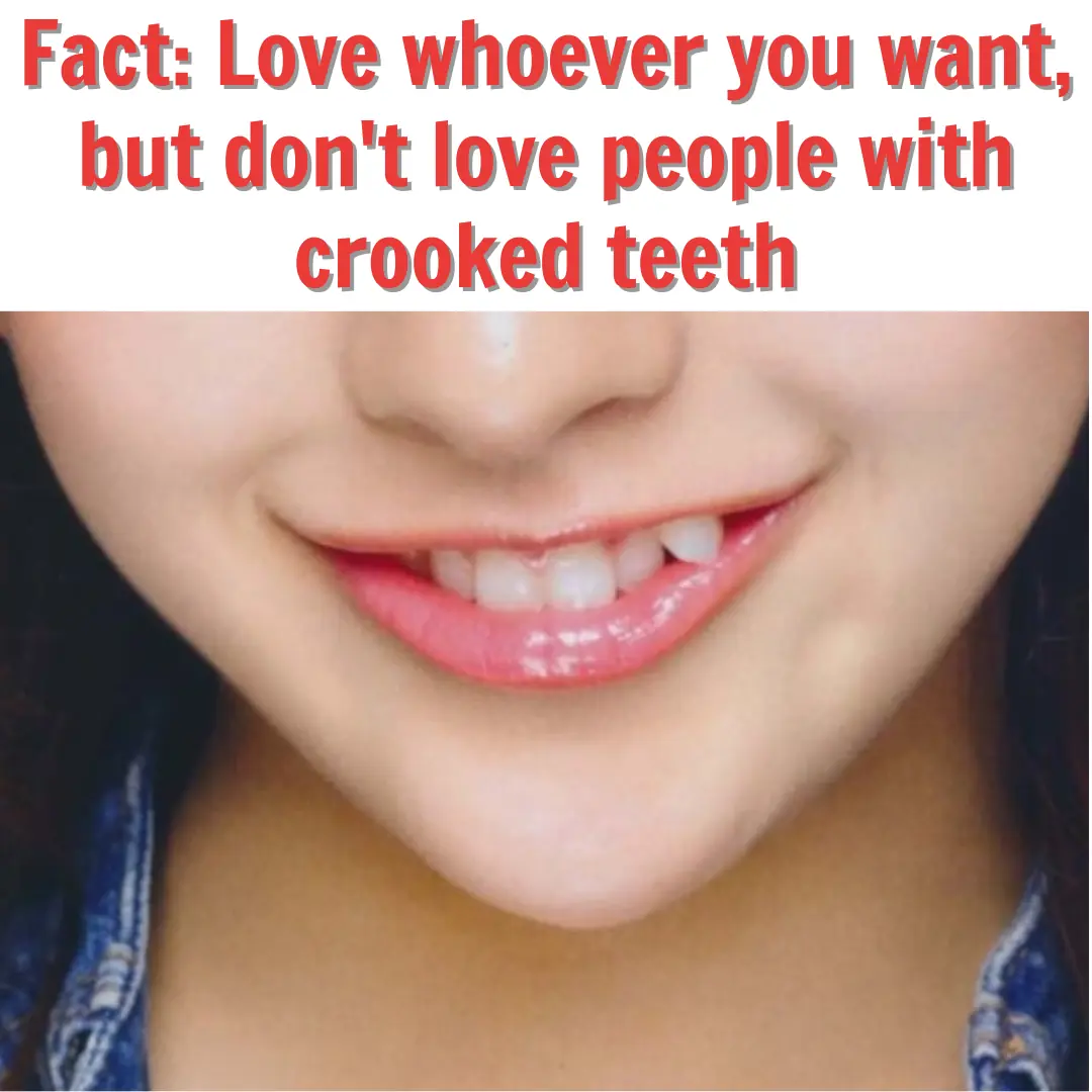 Fact: Love whoever you want, but don't love people with crooked teeth