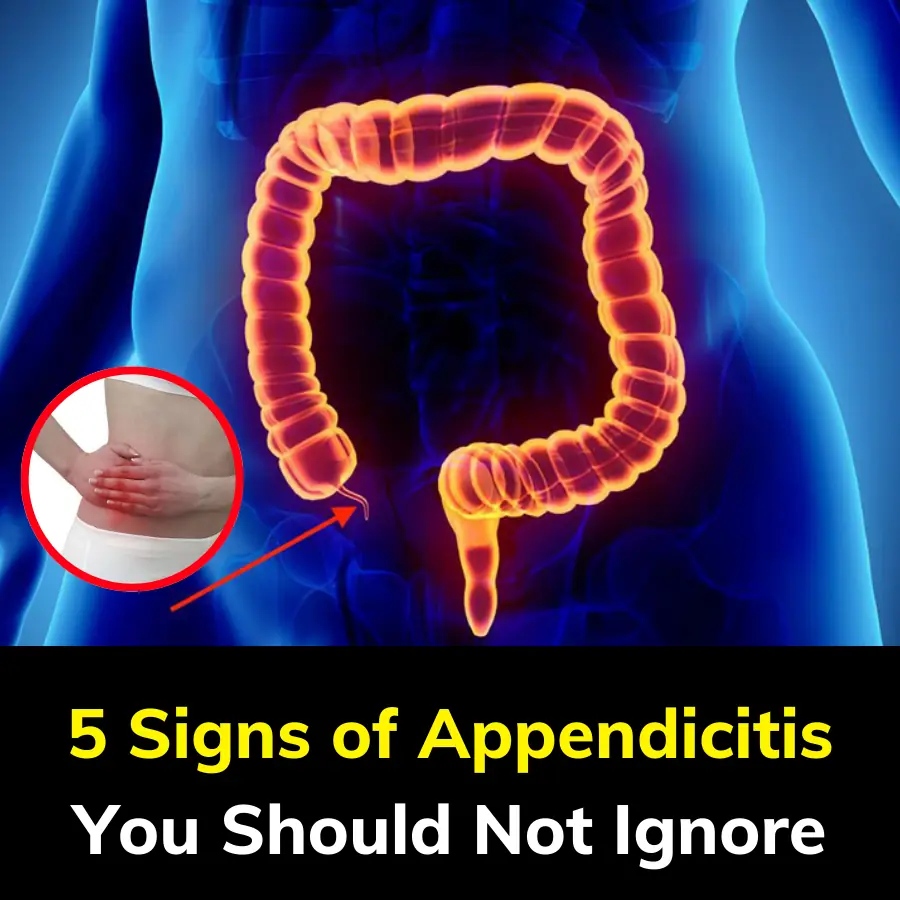 5 Signs of Appendicitis You Should Not Ignore
