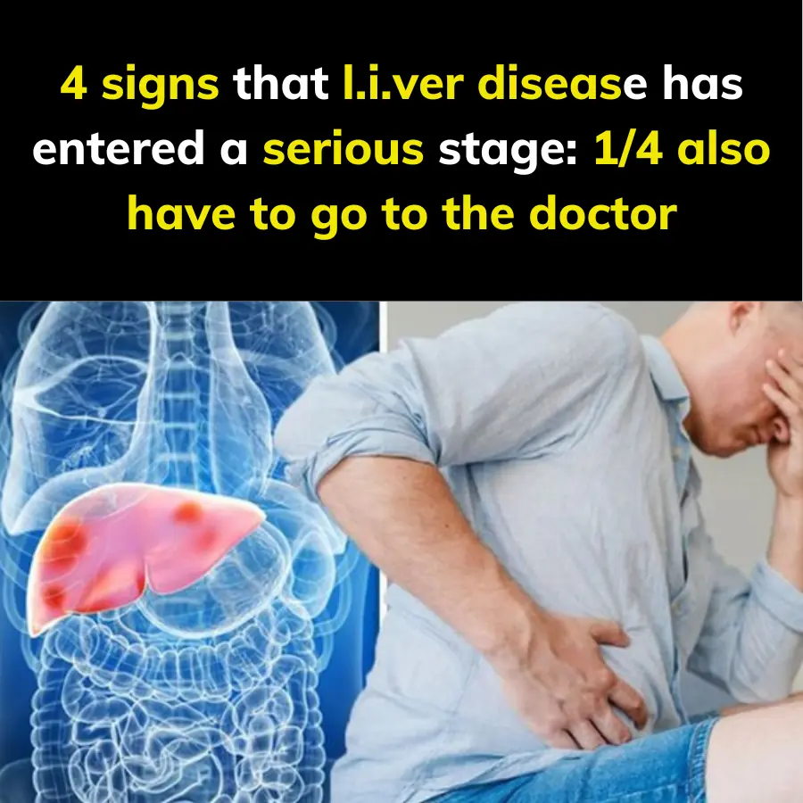 4 signs that liver disease has entered a serious stage: 1/4 also have ...