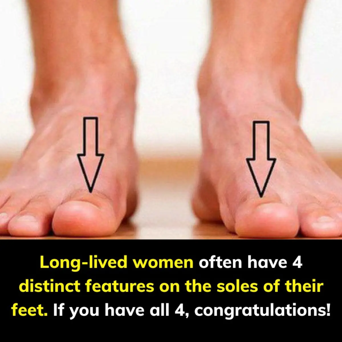 Long-lived women often have 4 distinct features on the soles of their feet