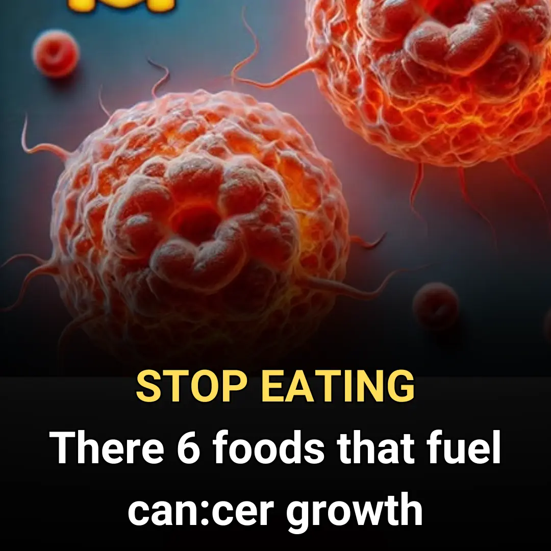 Hot Dogs and Processed Meats May Be the Most Dangerous Foods of All ...