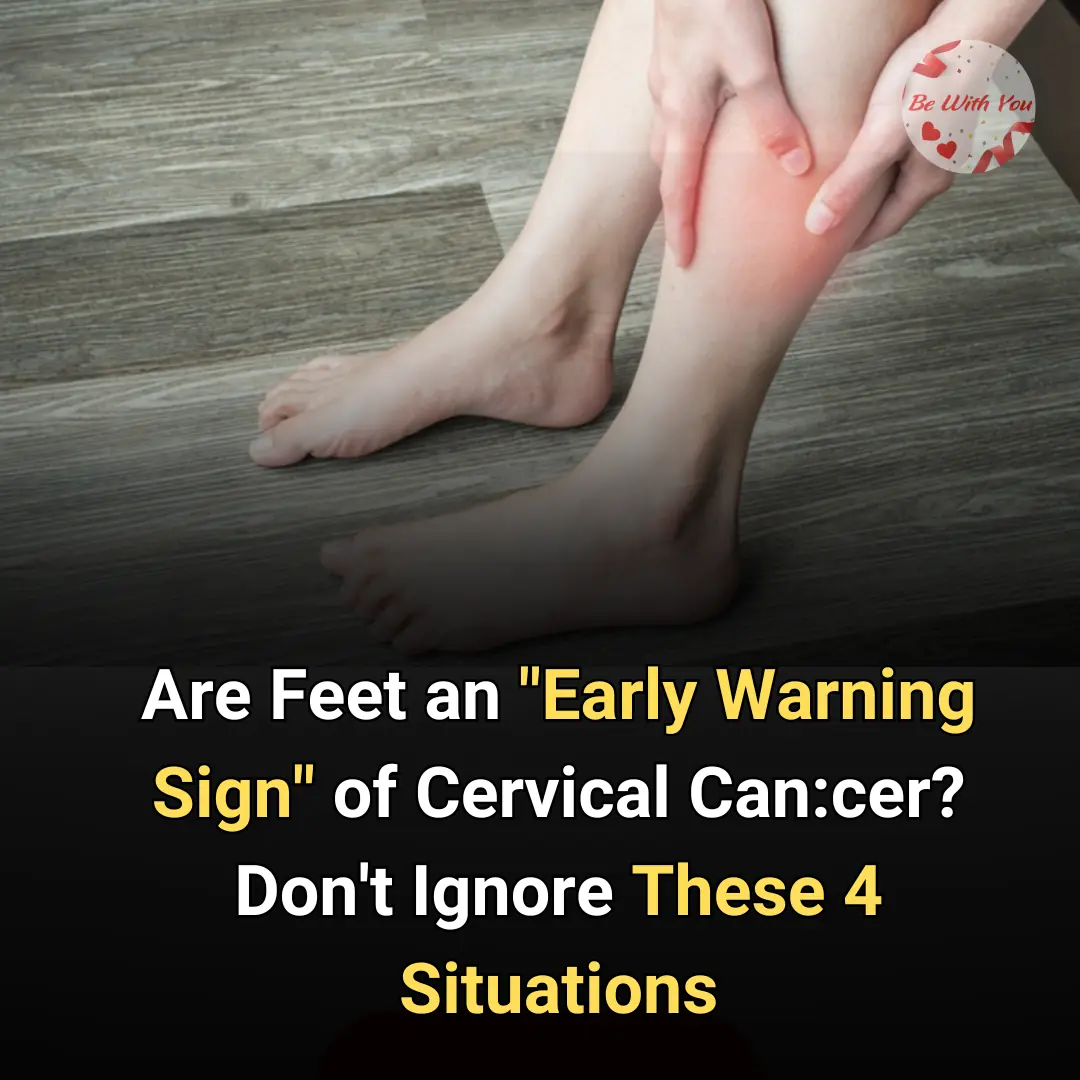 Are Feet an "Early Warning Sign" of Cervical Cancer? Don’t Ignore These ...