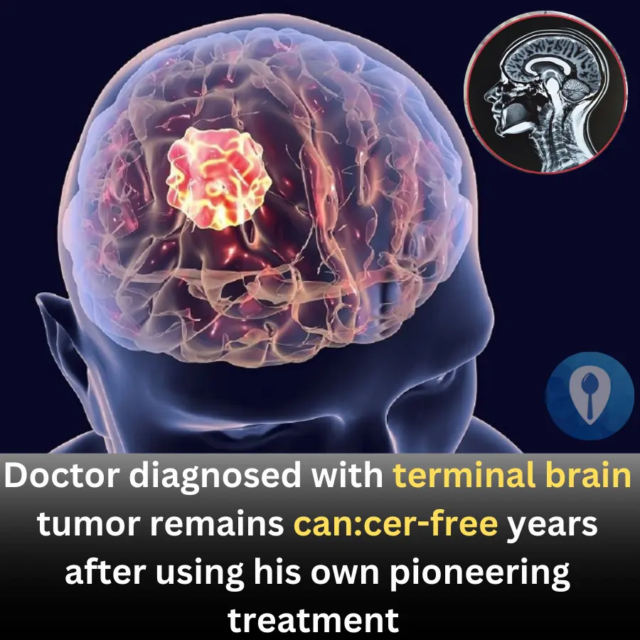 Doctor diagnosed with terminal brain tumor remains can:cer-free years ...