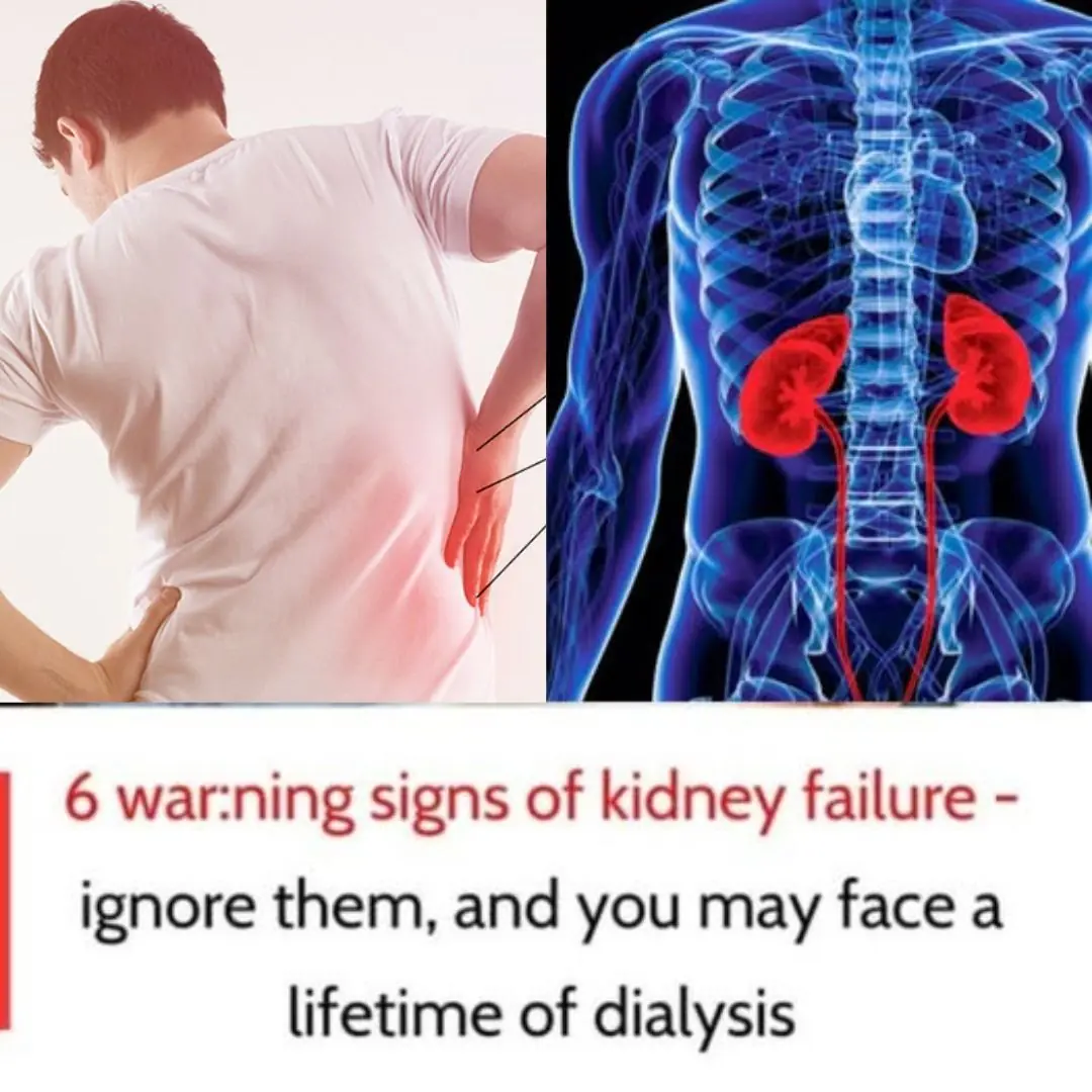 Kidney failure signs in youth to watch