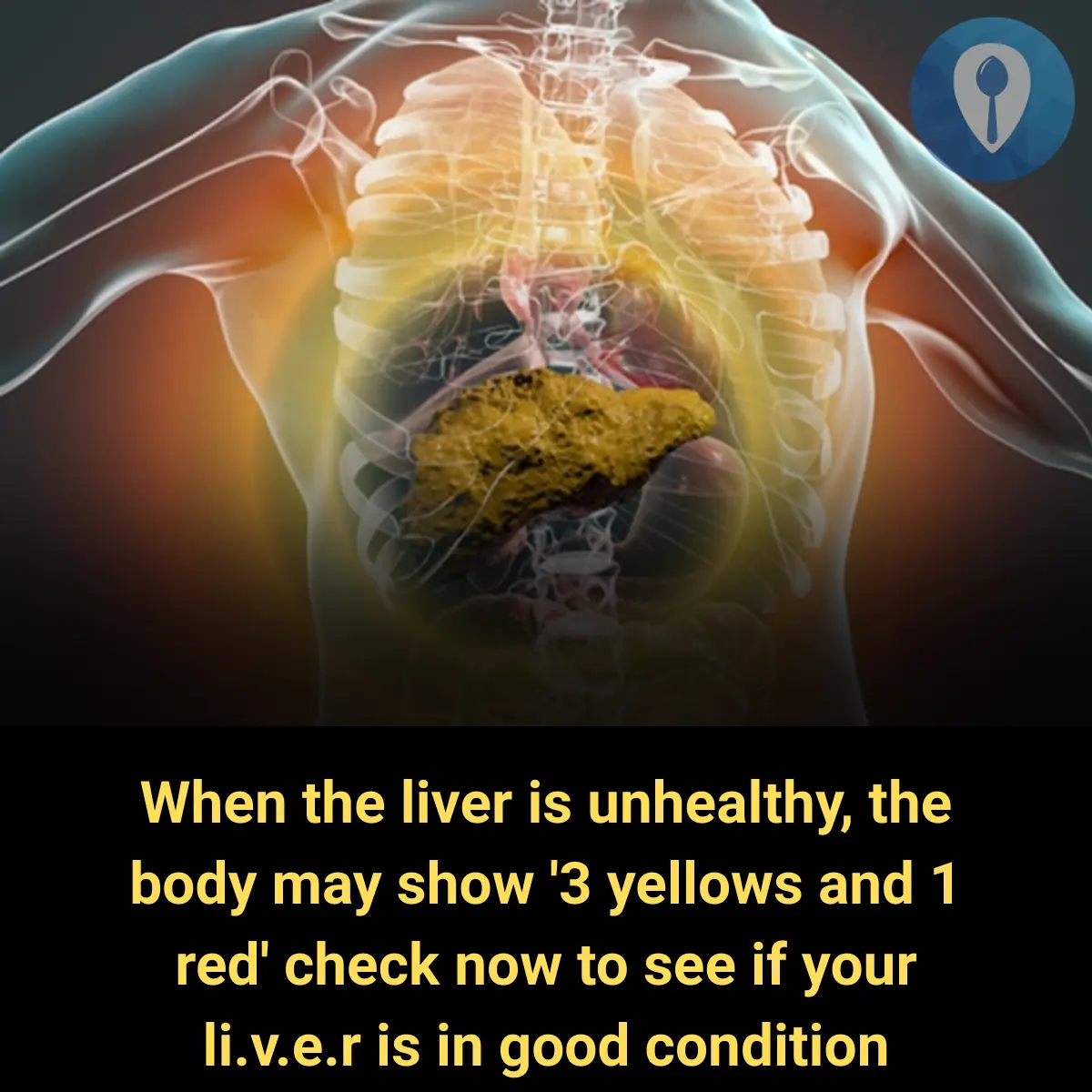 When the Liver Is Unhealthy, the Body May Show '3 Yellows and 1 Red'