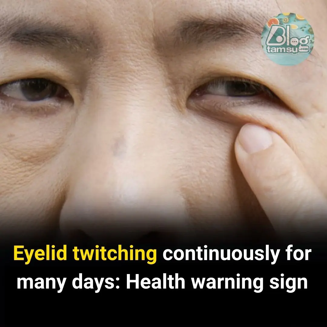 Why Your Eyelid Has Been Twitching Nonstop — And When to See a Doctor