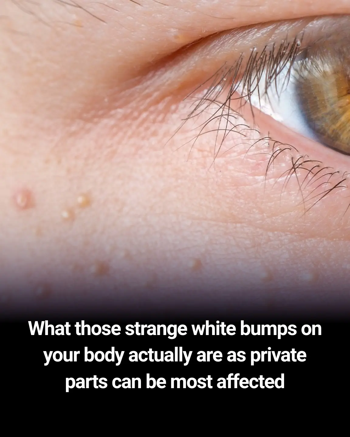 What those strange white bumps on your body actually are?