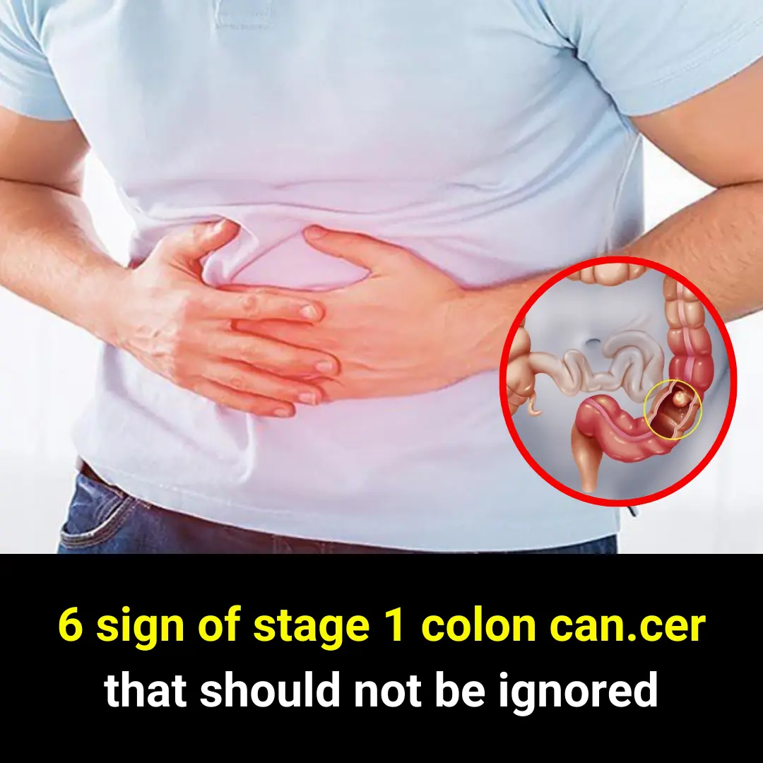 6 early warning signs of stage 1 colon can.cer you shouldn’t ignore