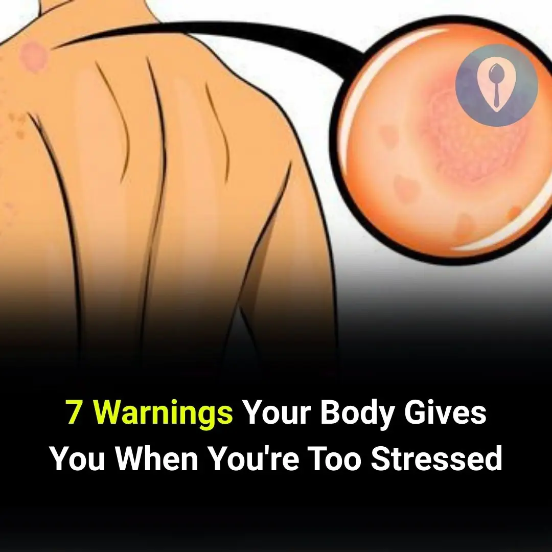 7 Warnings Your Body Gives You When You’re Too Stressed